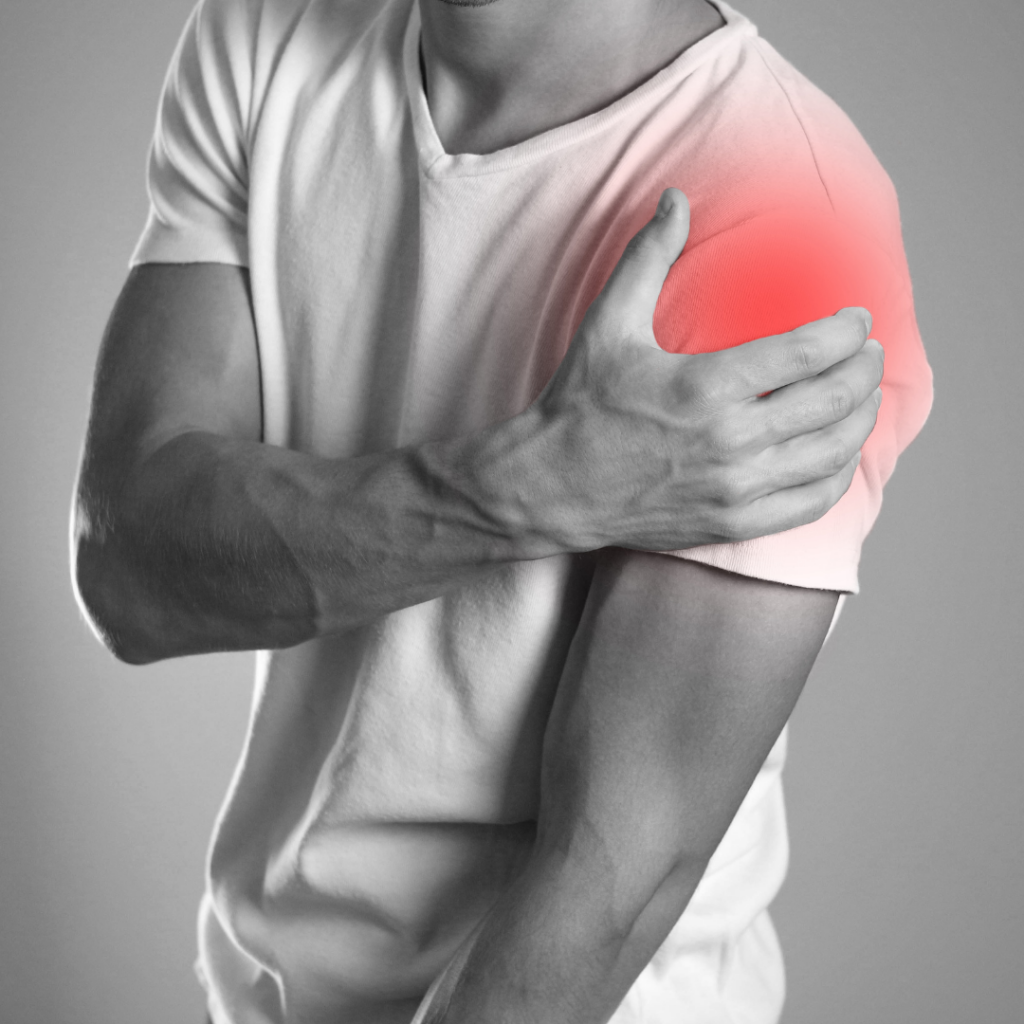 Shoulder 'Impingement' - Causes, Symptoms & Treatment