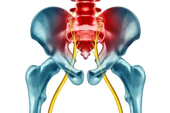 Sciatica Physiotherapy: Treatments & Exercises to Reduce Pain - Thrive ...